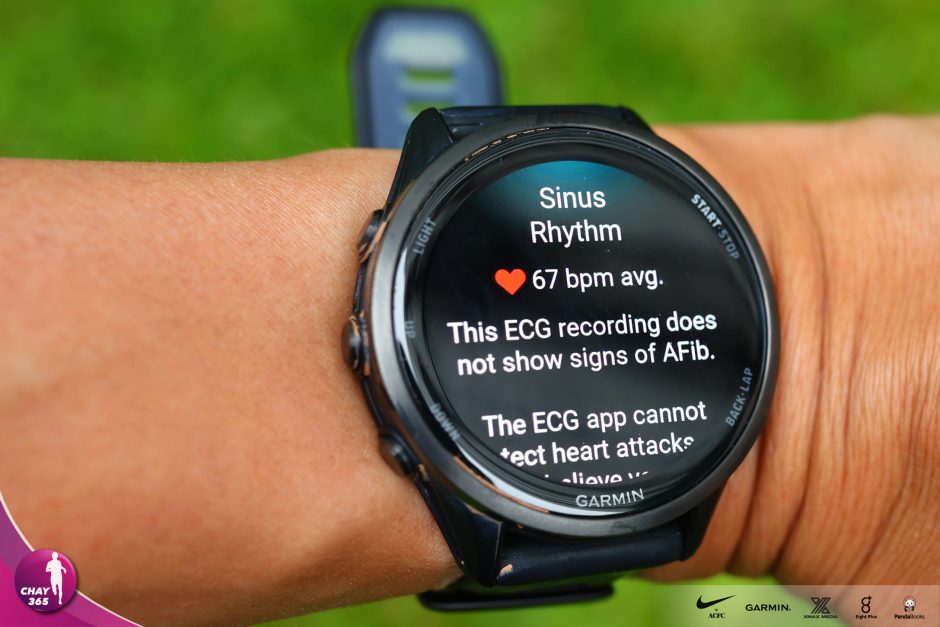Hiểu về ECG App của Garmin